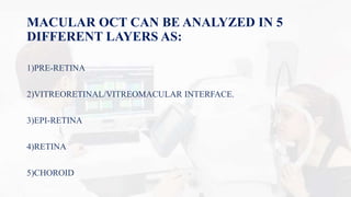 OCT MACULA INTERPRETATION. | PPTX