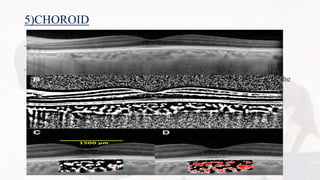 OCT MACULA INTERPRETATION. | PPTX