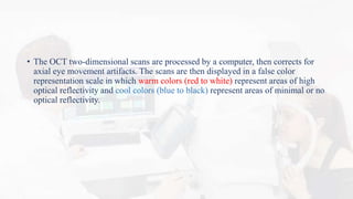 OCT MACULA INTERPRETATION. | PPTX
