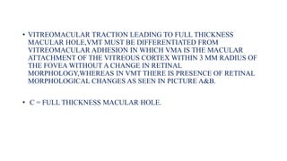 OCT MACULA INTERPRETATION. | PPTX