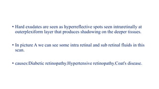 OCT MACULA INTERPRETATION. | PPTX
