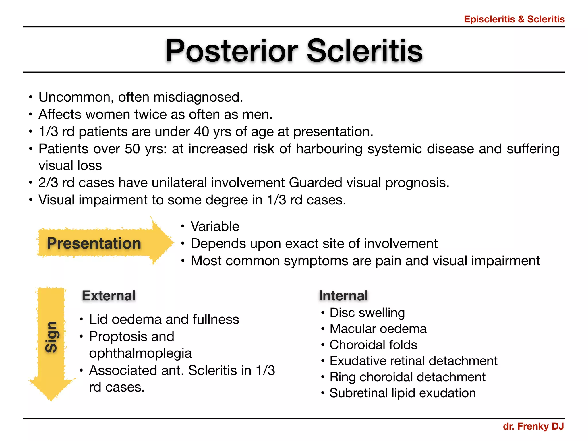 Episcleritis & Scleritis | PDF