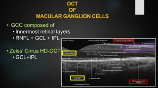 OCT in glaucoma ppt;1 | PPTX