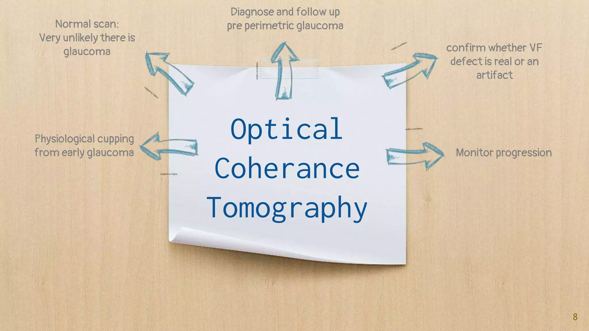 Interpretation of OCT(Glaucoma) | PPTX