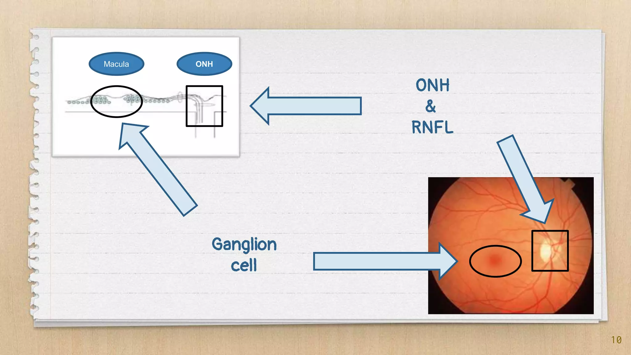 Interpretation of OCT(Glaucoma) | PPTX