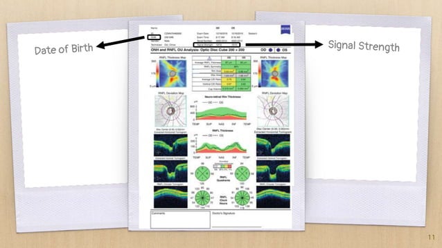 Interpretation of OCT(Glaucoma) | PPTX