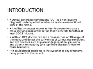 OPTICAL COHERENCE TOMOGRAPHY IN GLAUCOMA Presentation.pptx