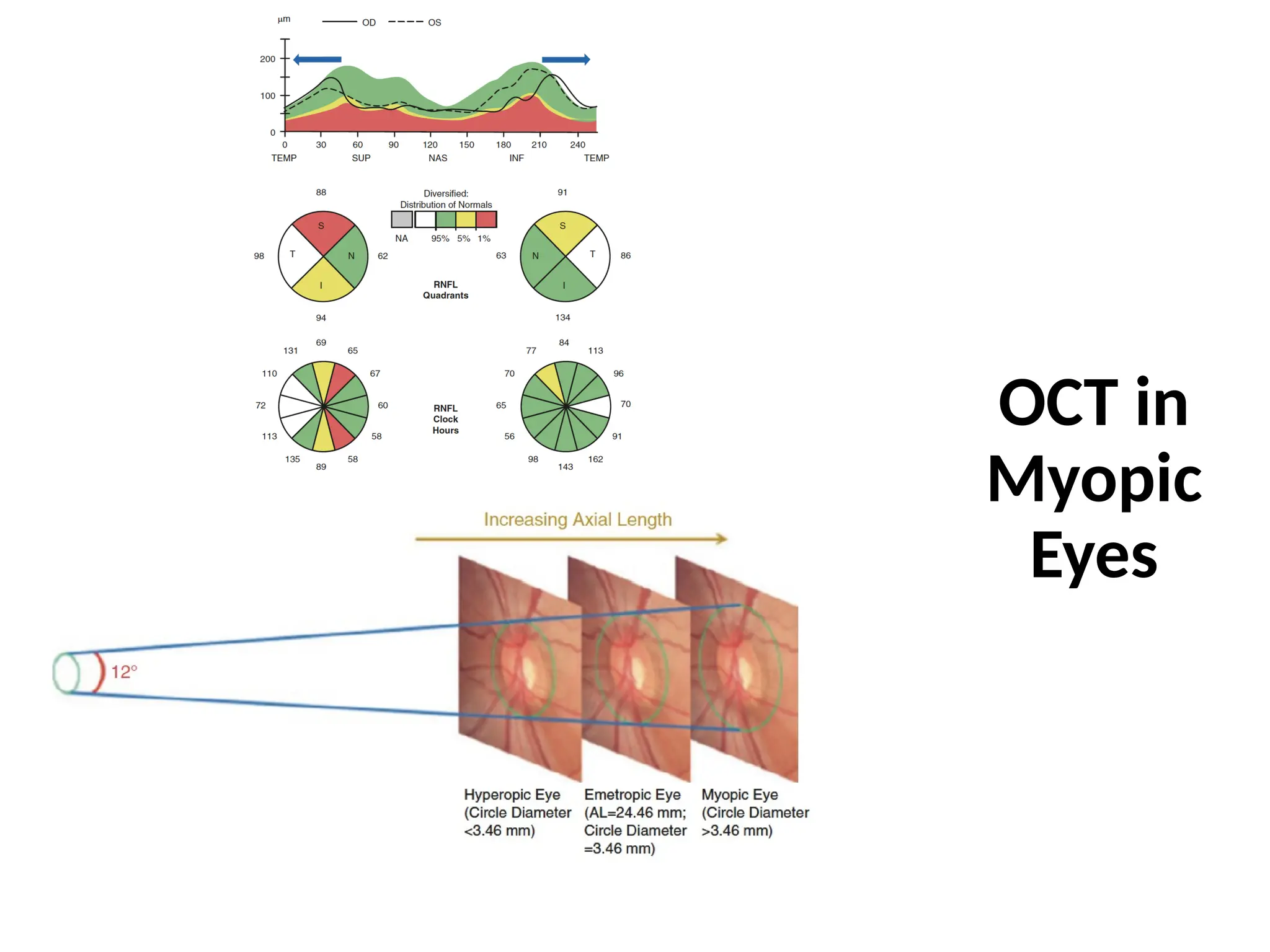 OCT in Glaucoma umesh- showing a Glaucoma | PPT