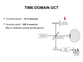 OCT in Glaucoma umesh- showing a Glaucoma | PPTX
