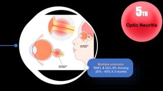 OCT Biomarkers in neuro-ophthalmic disorders | PPTX