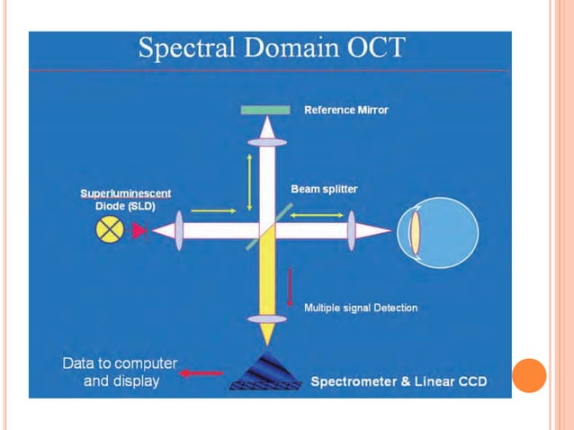 Optical Coherence Tomography(OCT) in posterior segment diseases | PPT