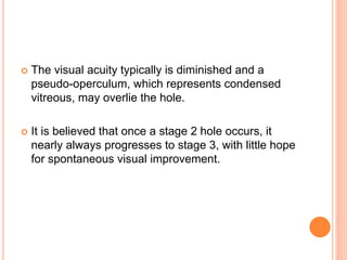 Optical Coherence Tomography(OCT) in posterior segment diseases | PPT