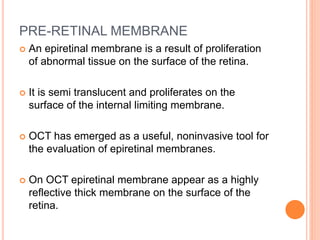 Optical Coherence Tomography(OCT) in posterior segment diseases | PPT