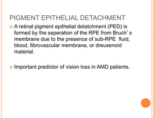 Optical Coherence Tomography(OCT) in posterior segment diseases | PPT