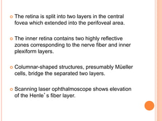 Optical Coherence Tomography(OCT) in posterior segment diseases | PPT
