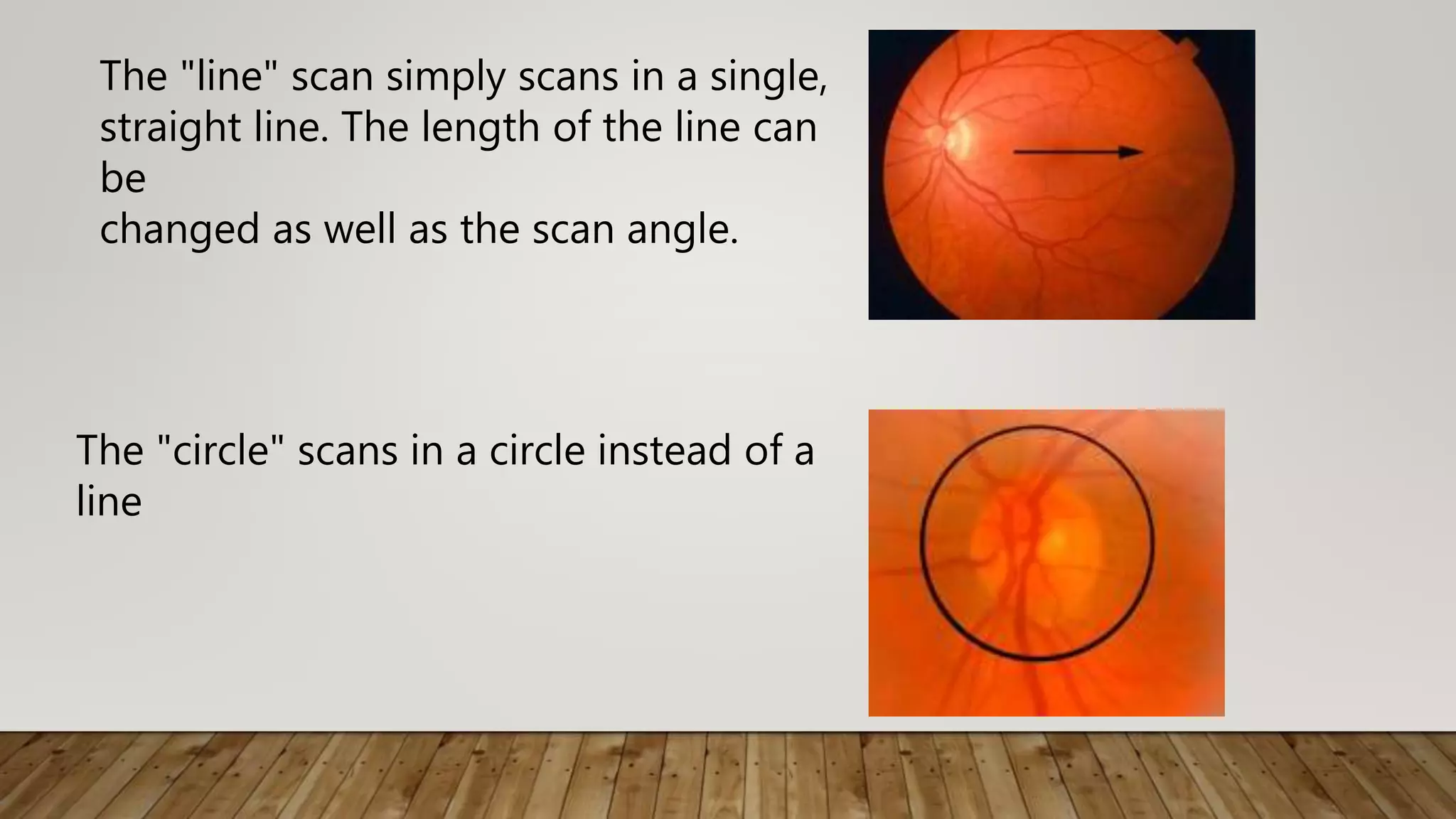 Oct in post seg disorders | PPTX