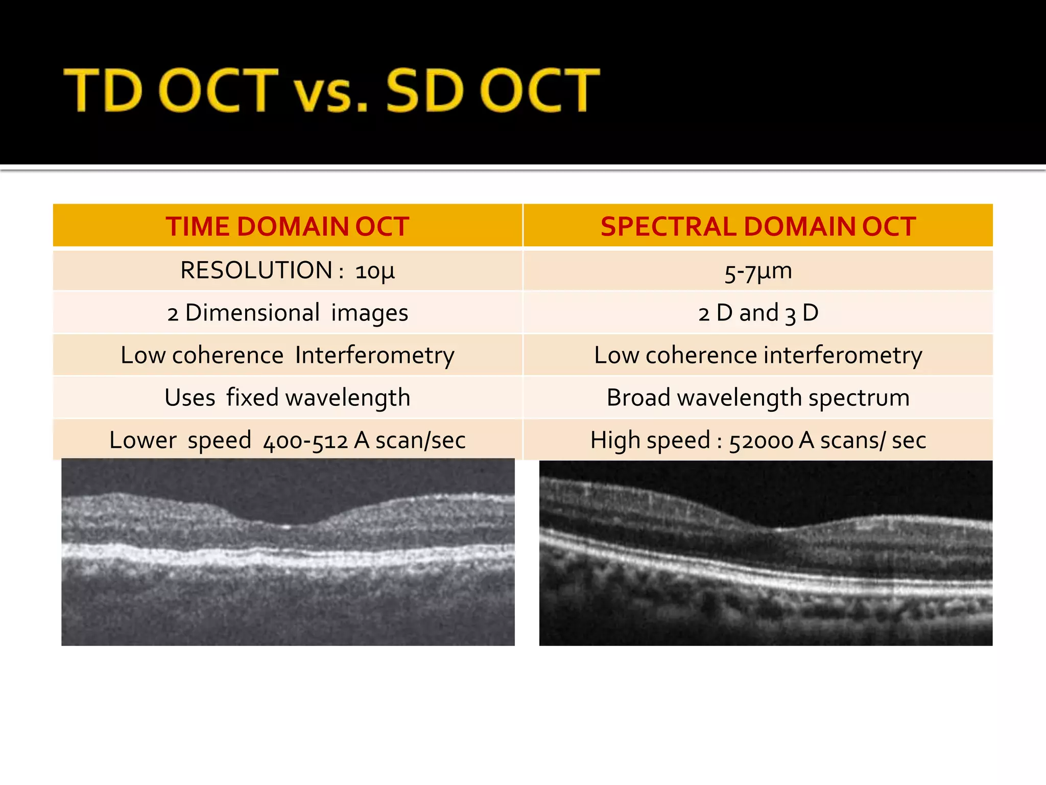 OCT – Introduction and Macular disorders | PPTX