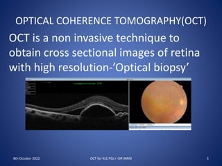 DR WANI'S TALK ON Optical coherence tomography of posterior segment FOR ...
