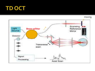 Optical coherence tomography and its principle