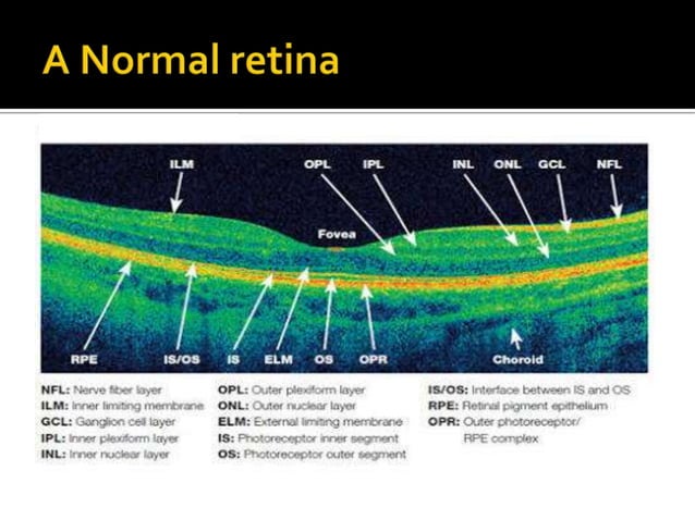Optical coherence tomography and its principle