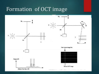 Oct(optical cohorence tomography) | PPTX