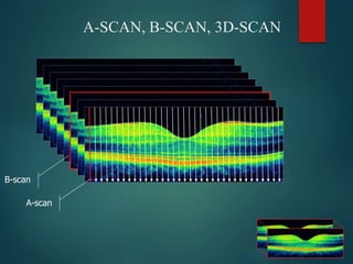 Oct(optical cohorence tomography) | PPT