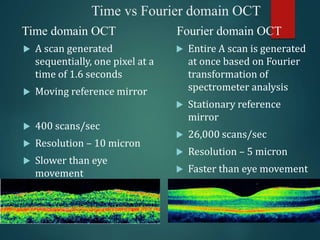 Oct(optical cohorence tomography) | PPT