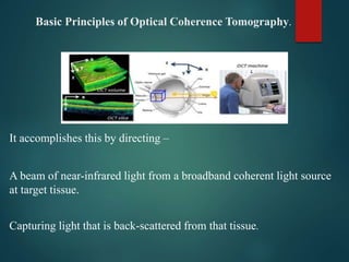 Oct(optical cohorence tomography) | PPT