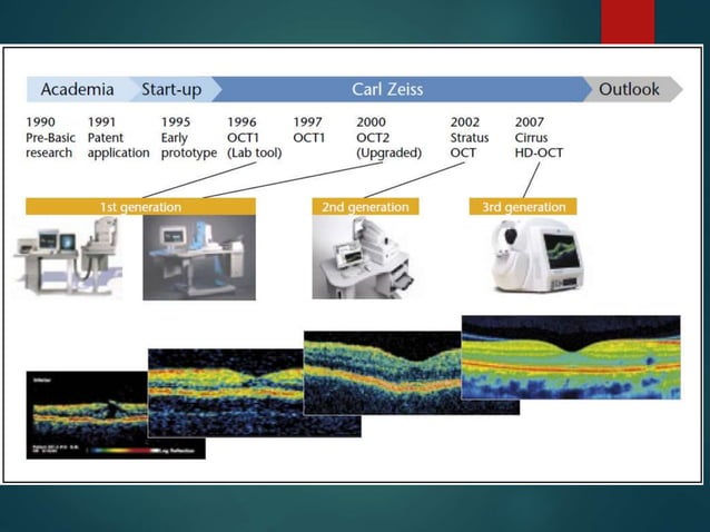 Oct(optical cohorence tomography) | PPT