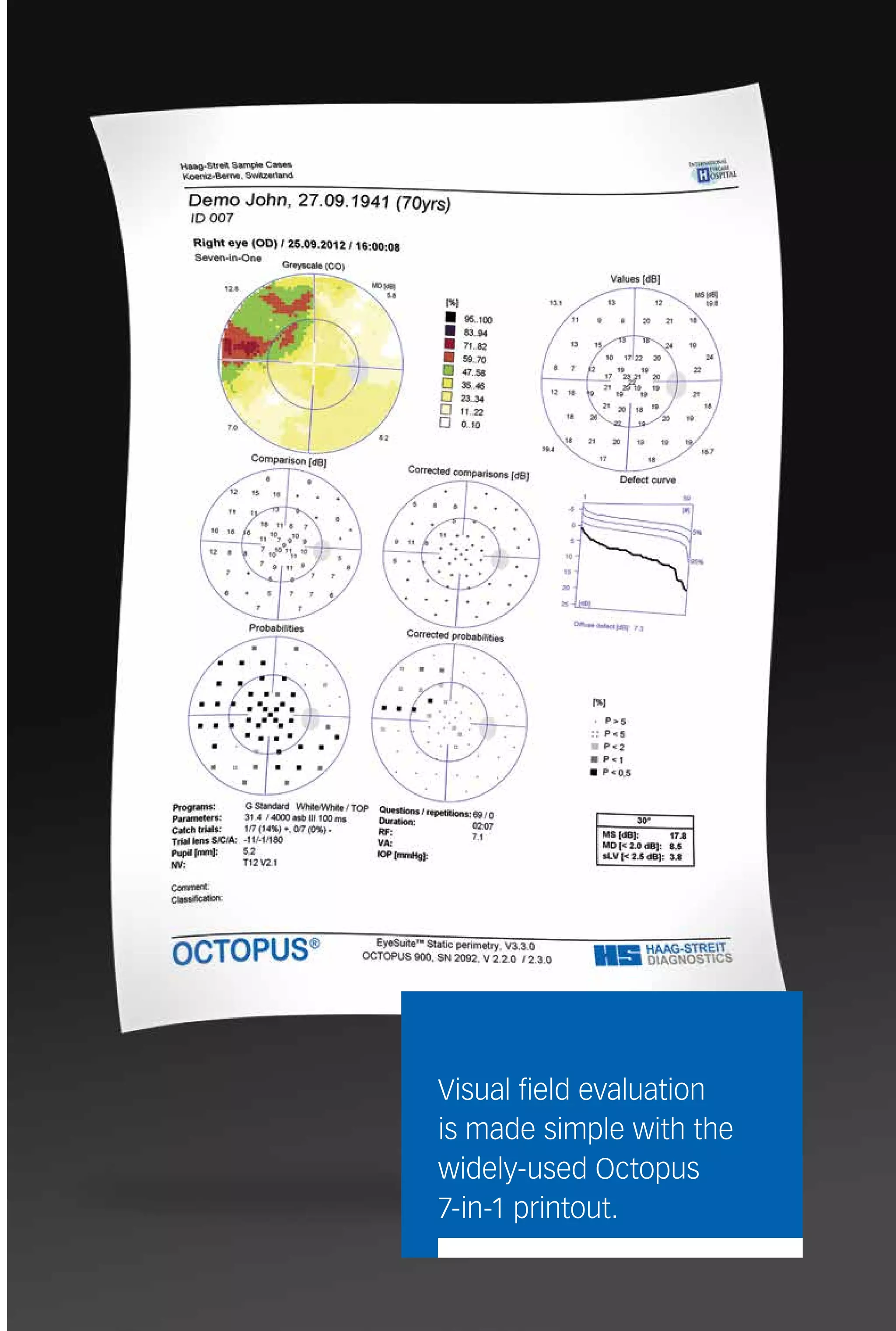 Octopus 900 Brochure | PDF