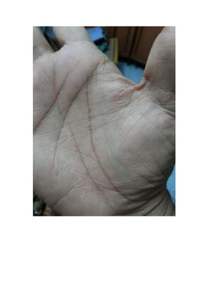 Octopus hal headline from giftmarkers . | PDF