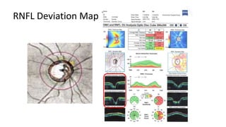 OCT Resident class.pptx