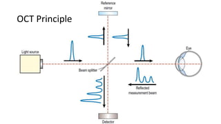 OCT Resident class.pptx