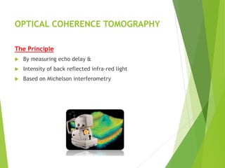 Optical Coherence Tomography [OCT] | PPTX