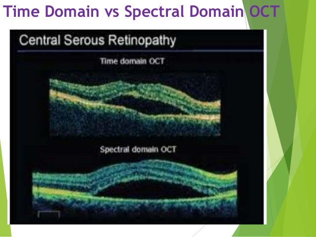 Optical Coherence Tomography [oct]