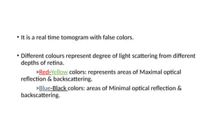 Optical coherence Tomography basics in Ophthalmology | PPTX