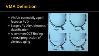 OCT of Vitreomacular interface (VMI) | PPT