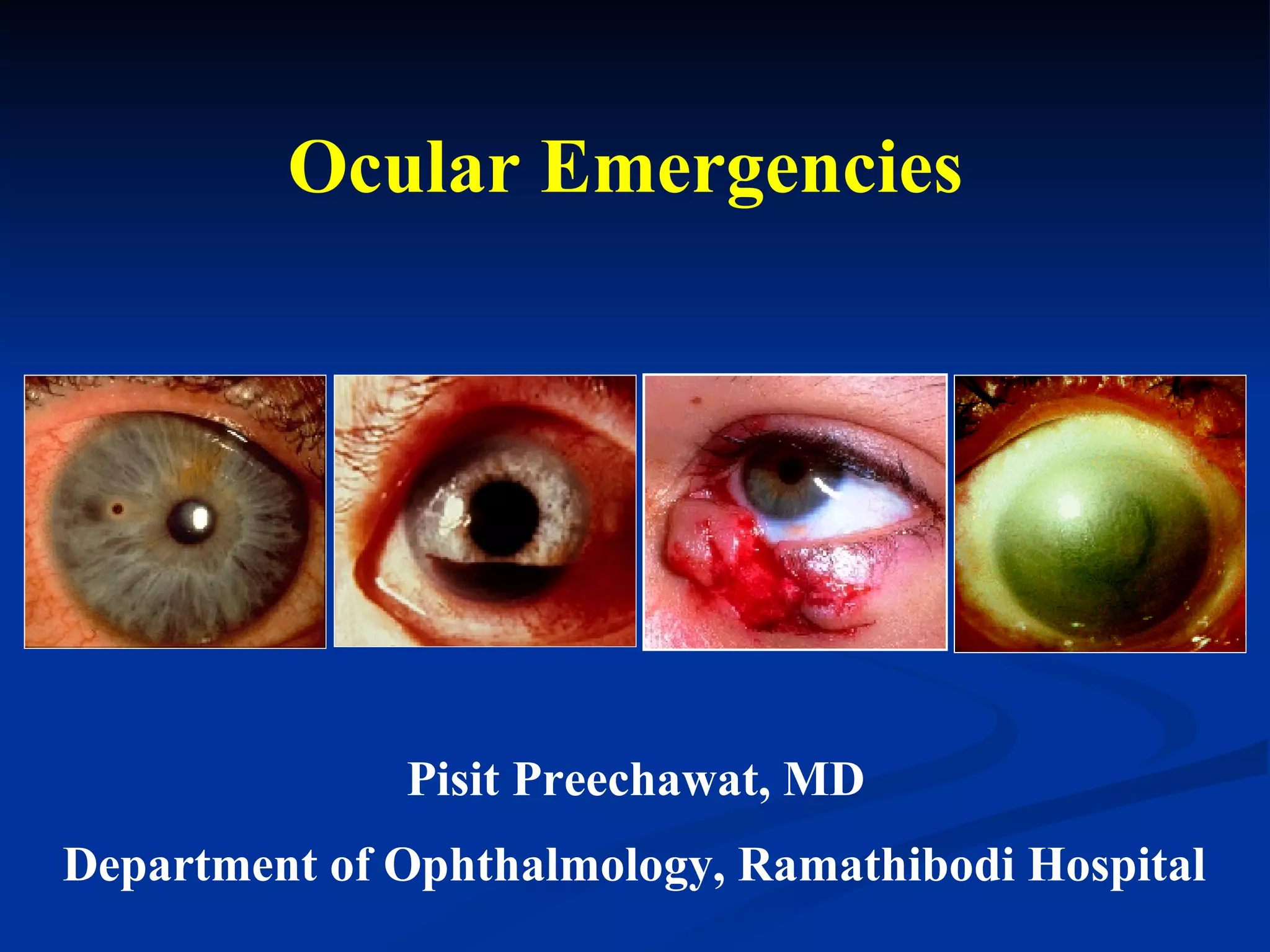 Ocular Emergency | PPT