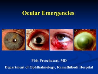 Ocular Emergency | PPT