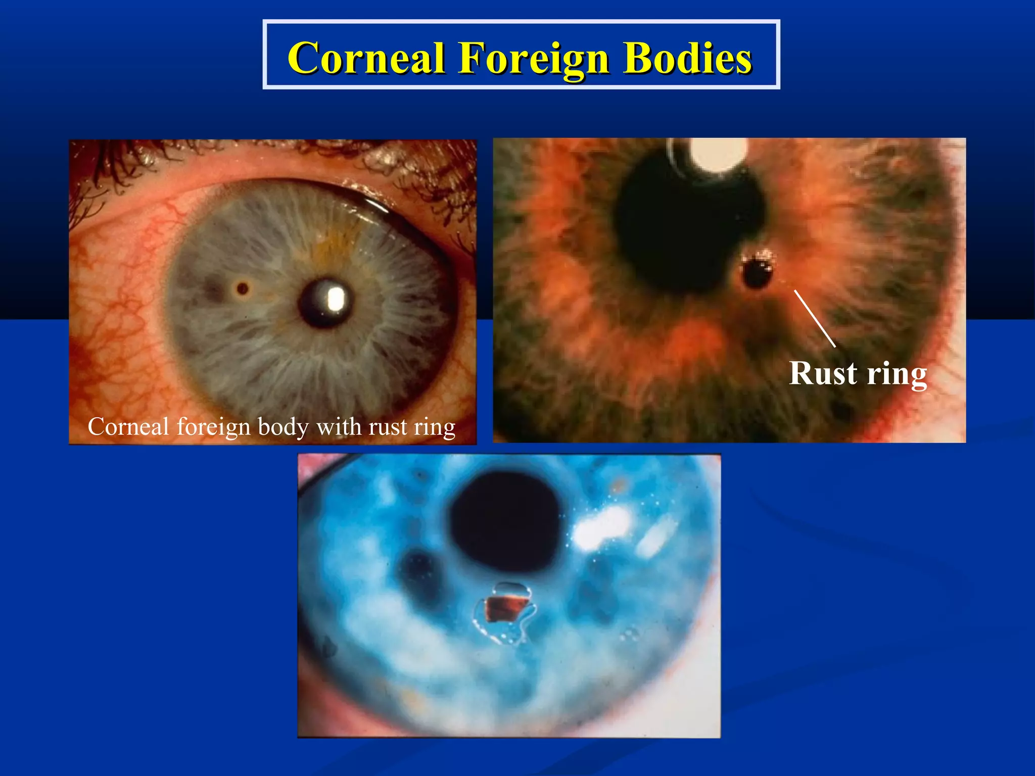 Ocular emergency- | PPT