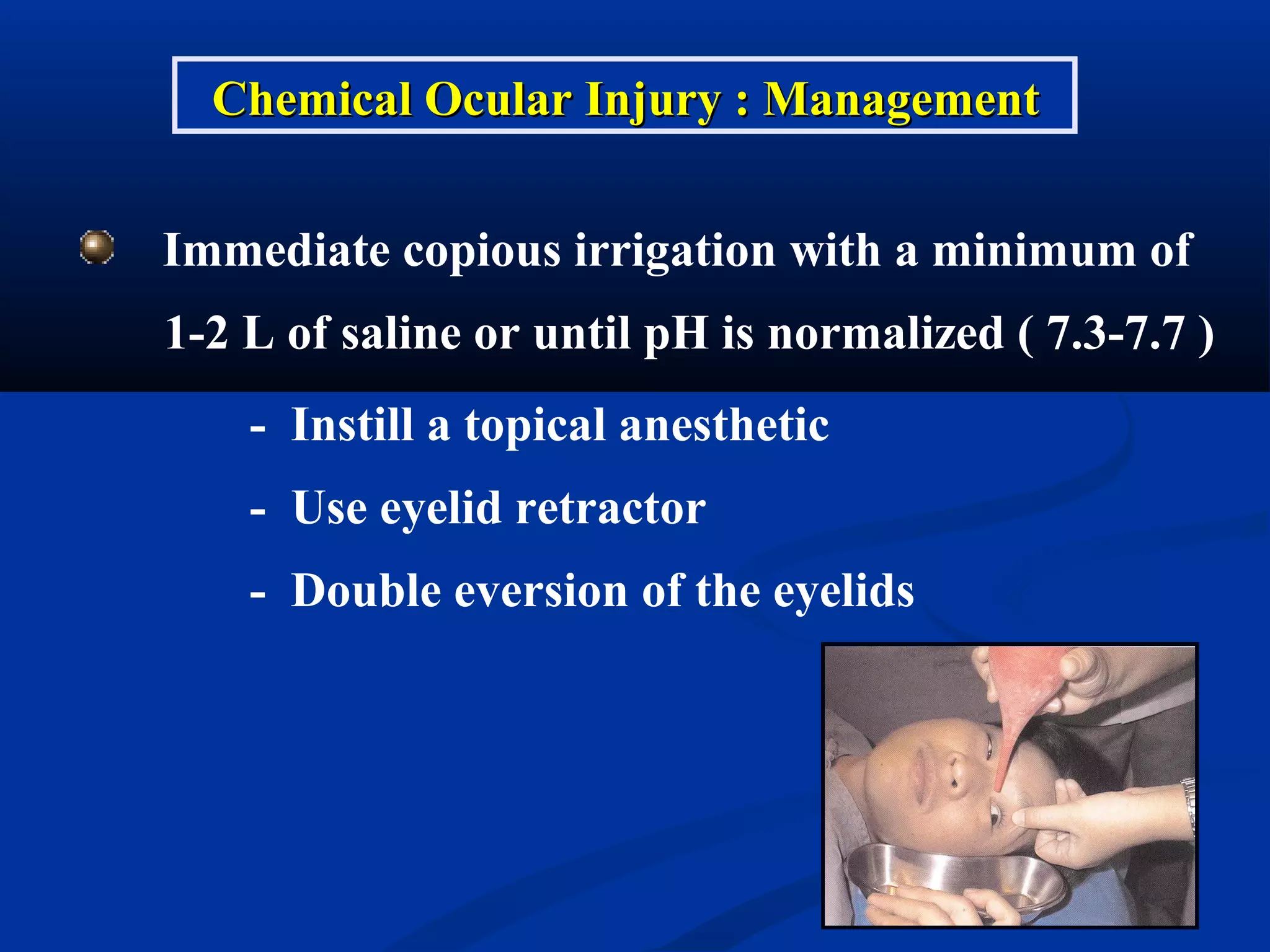 Ocular emergency- | PPT