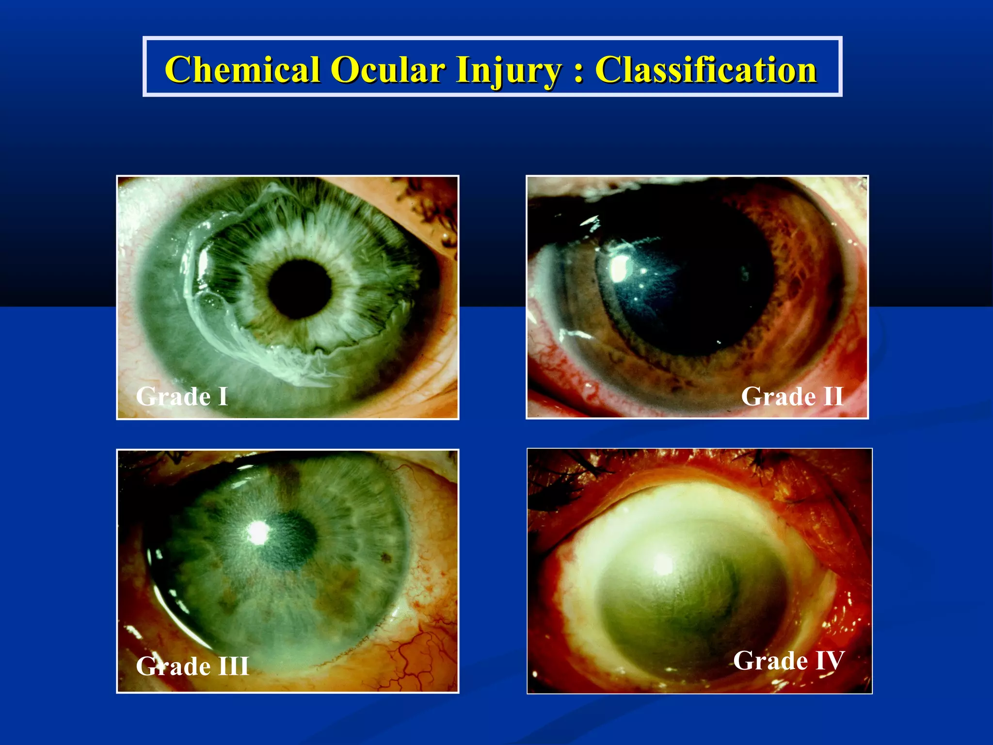 Ocular emergency- | PPT