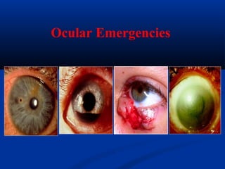 Ocular emergency- | PPT