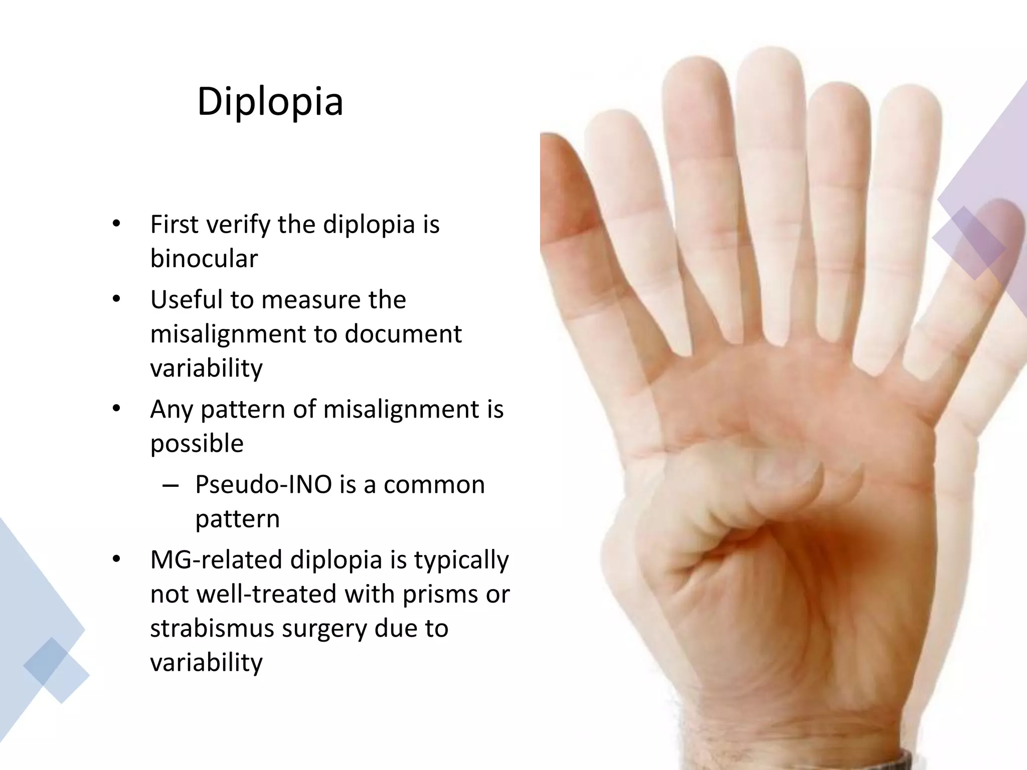 Ocular myasthenia gravis | PDF