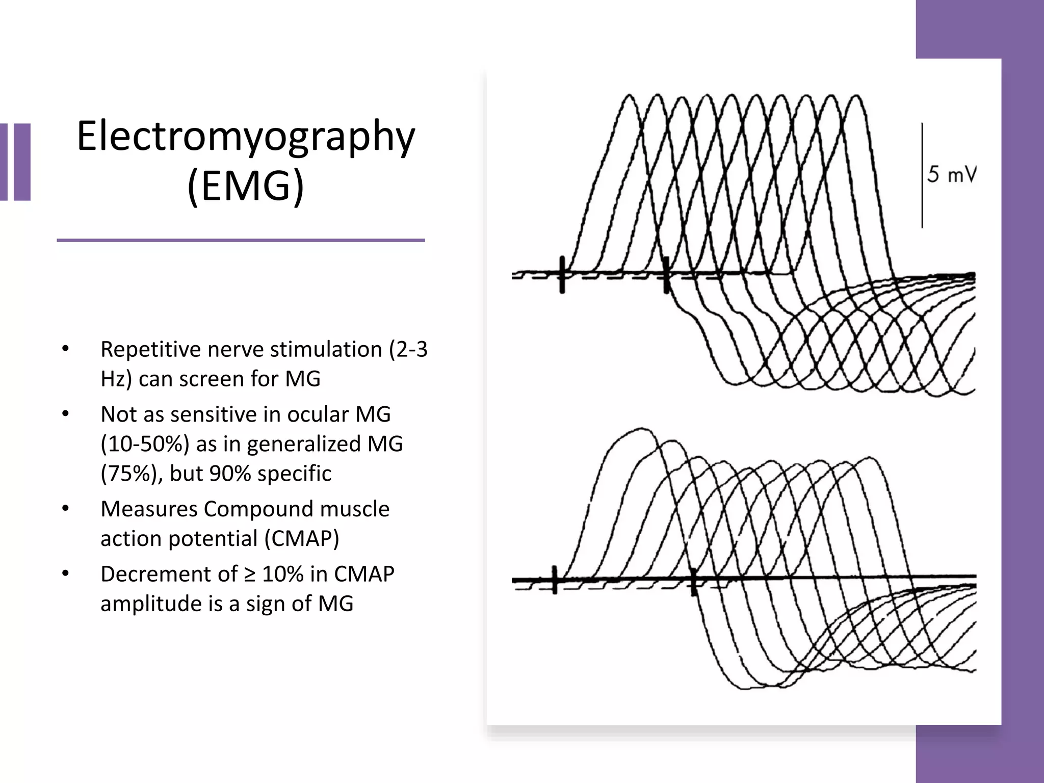 Ocular myasthenia gravis | PDF