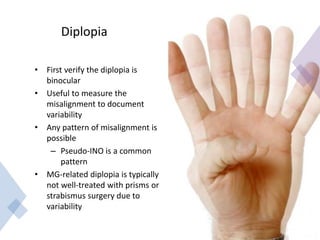 Ocular myasthenia gravis | PDF