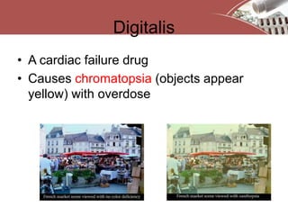 Ocular pharmacology | PPTX