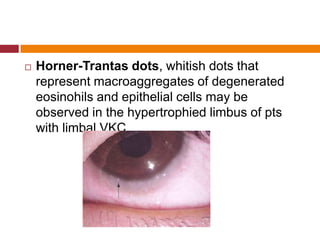Ocular allergy | PPTX