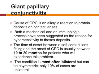 Ocular allergy | PPTX