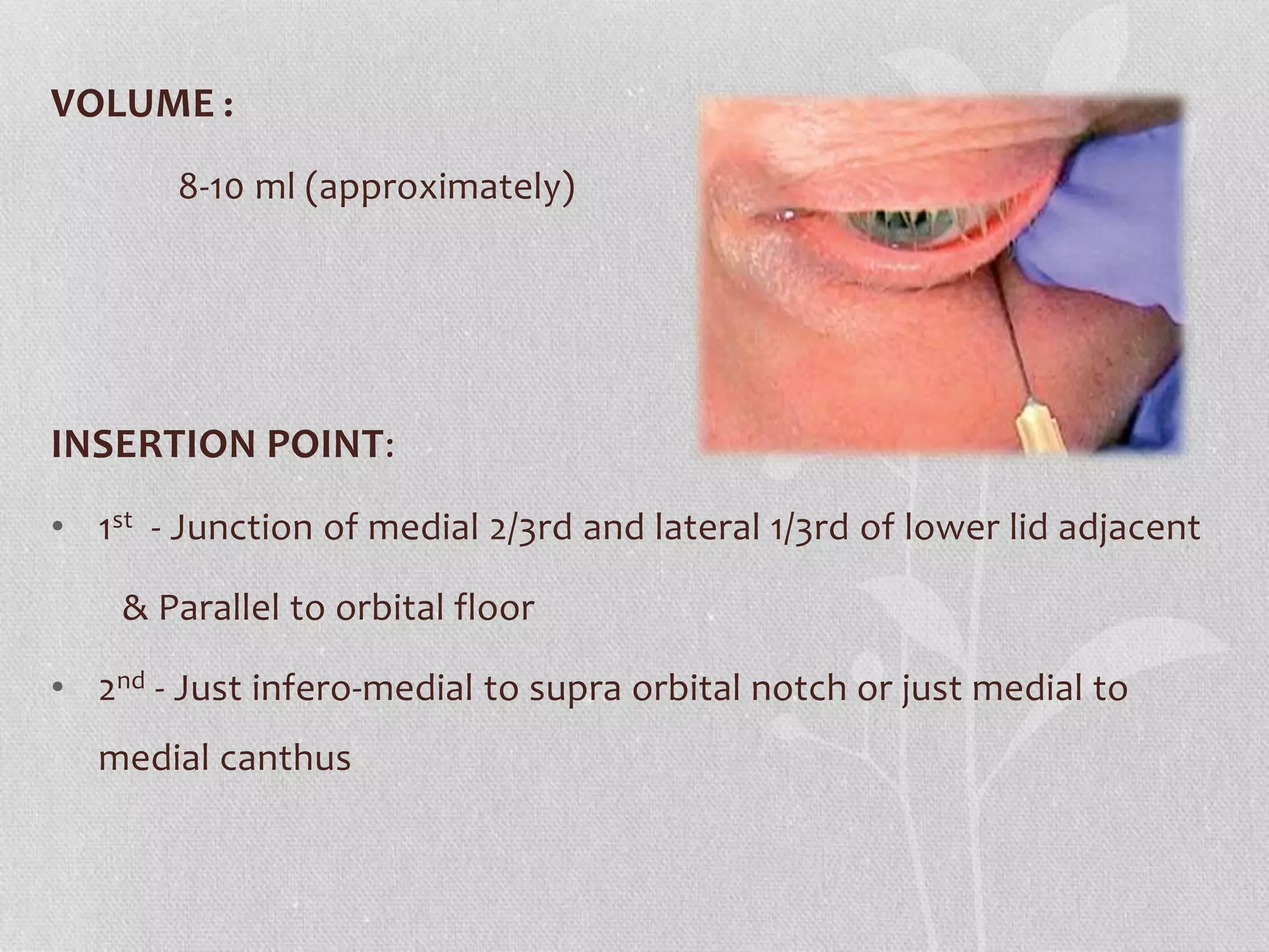 Ocular anaesthesia | PPTX